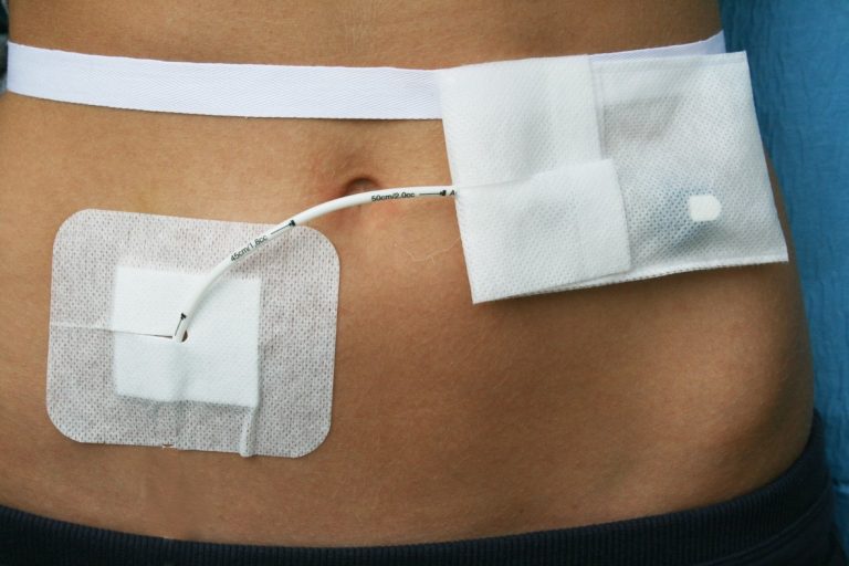 UTILIZZO EXIT-POCKET PT E EXIT-PRO AG INSIEME | Emodial